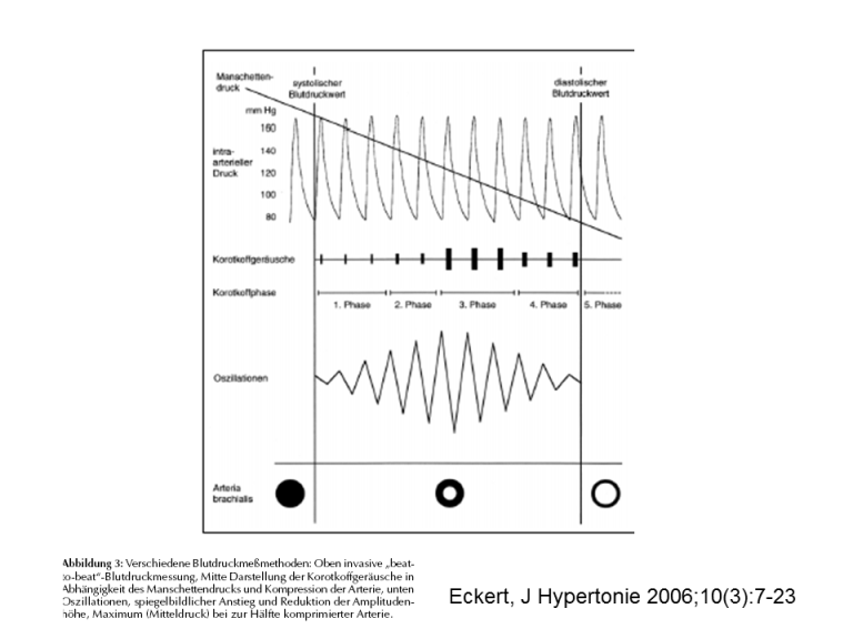 „Scipione Riva Rocci und die Historie der Blutdruckmessung“ von Dr ...