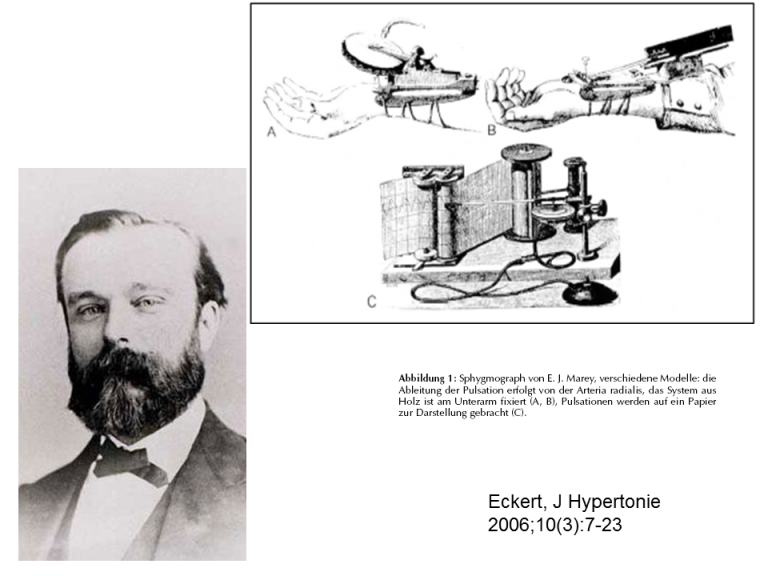 „Scipione Riva Rocci und die Historie der Blutdruckmessung“ von Dr ...